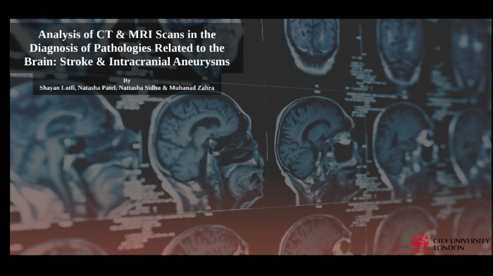 Analysis of CT and MRI scans in the diagnosis of pathologies related to ...