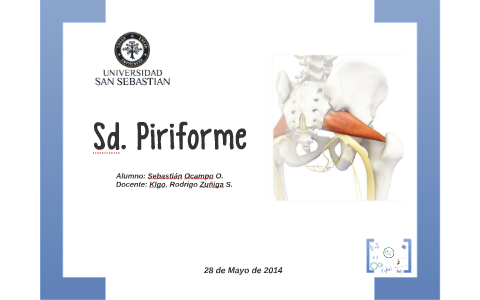 Sd. Piriforme by Sebastián Ocampo