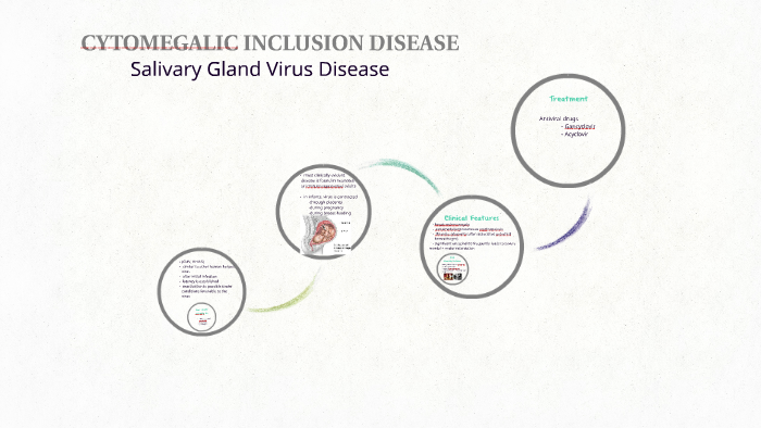 Cytomegalic Inclusion Disease By Crizel Astrid Blaza On Prezi