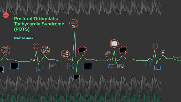 Postural Orthostatic Tachycardia Syndrome (POTS) by Sarah Caldwell on Prezi
