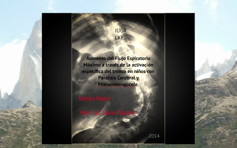 Aumento del Flujo Espiratorio Máximo a través de la activaci by Nadia ...