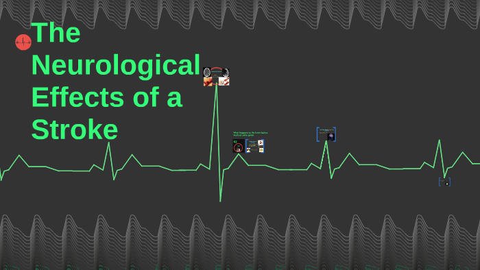 The Neurological Effects of a Stroke by sean brehon on Prezi