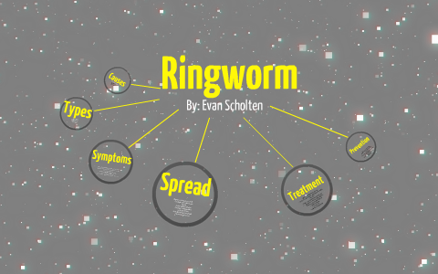 Anatomy: Ringworm by Evan Scholten on Prezi