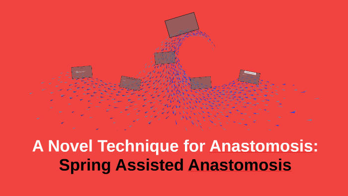 A Novel Technique for Anastomosis: Spring Assisted Anastomos by Jason ...