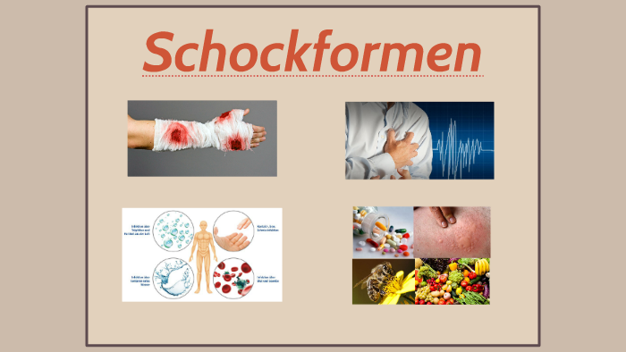 Welche Schockarten Gibt Es – Schockformen Tabelle – RUAUE