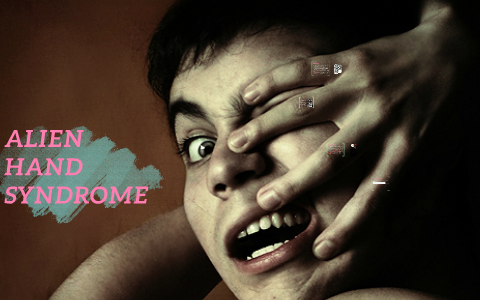 Alien hand syndrome by Ashlyn Morrone on Prezi