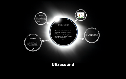 Ultrasound by seb cooper on Prezi