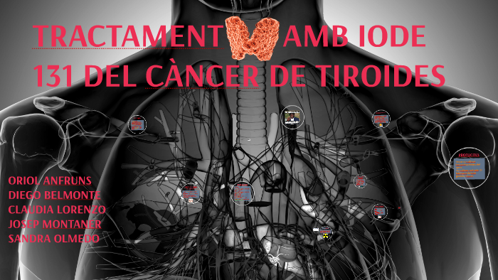 TRACTAMENT AMB IODE 131 by Diego Belmonte Martin on Prezi