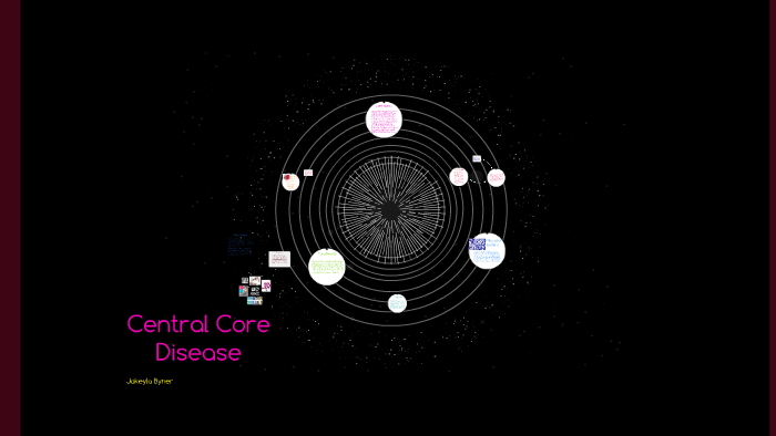 Central Core Disorder by JaKeyla Byner