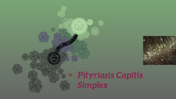 Pityriasis Capitis Simplex by Brianna Fourman on Prezi