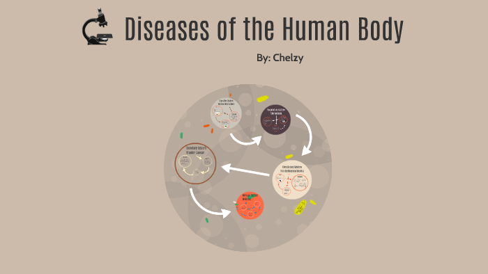 Diseases of the Human Body by Chelzy Evangelista on Prezi