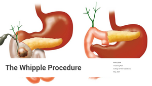 The Whipple Procedure by Anna Leach on Prezi Design