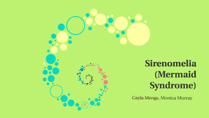 Sirenomelia (Mermaid Syndrome) by Cayla Menges on Prezi