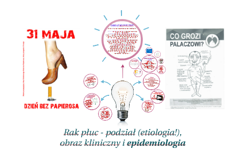 Rak płuc - etiologia i obraz kliniczny by Ola Gawarecka on Prezi