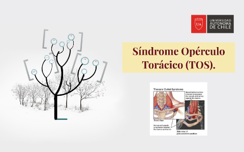 Opérculo Torácico. by Julio Hidalgo Torres