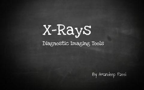 X-Rays by Aman Passi on Prezi