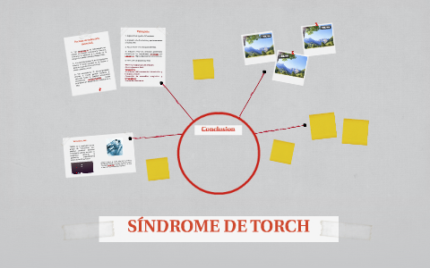 SÍNDROME DE TORCH by Miguel Angel Velasco on Prezi