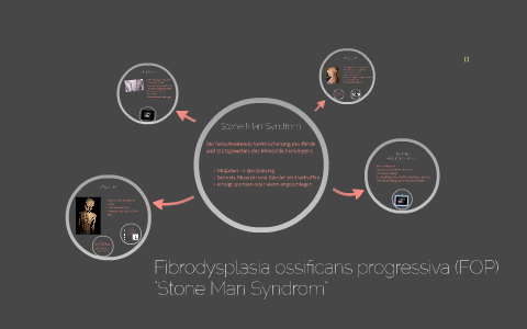 Fibrodysplasia ossificans progressiva (FOP) by allen grau