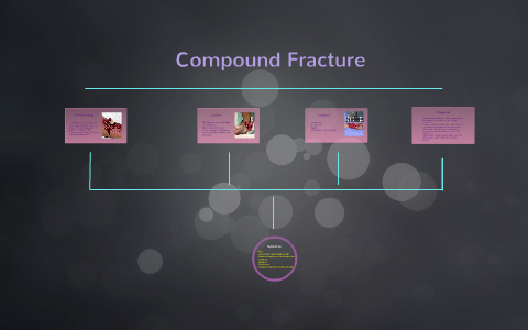 Compound Fracture by Casey Coble