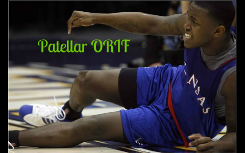 ORIF Patella by cameron walker on Prezi