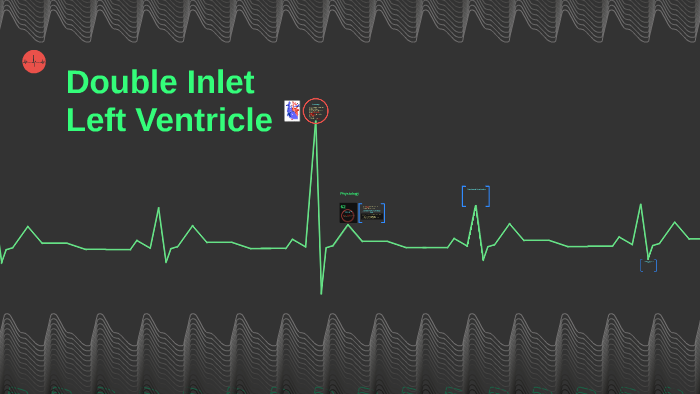 Double Inlet Left Ventricle by Meghan Carroll on Prezi