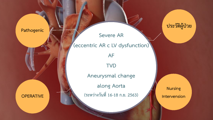 AVR (Tissue valse) + CABG x 2(SVG-OM1-LAD) + AAo replacement ...
