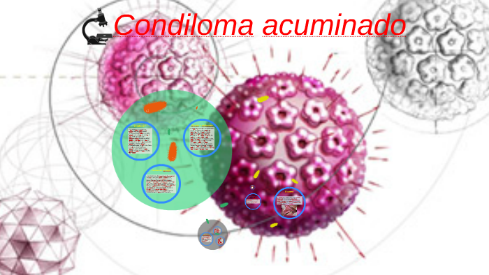 Condiloma Cuminado by Amanda Carolina on Prezi