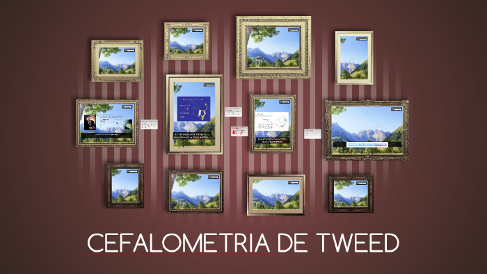 CEFALOMETRIA DE TWEED by carolina rivera on Prezi
