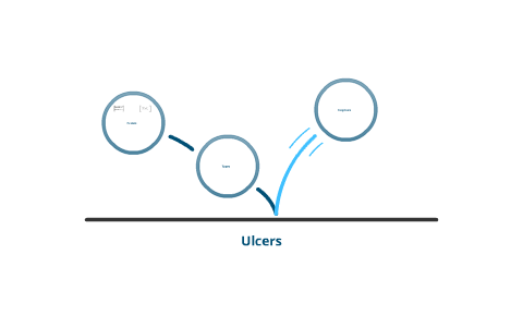 Ulcers: Causes, Types and Diagnosis by Carlos Alonso