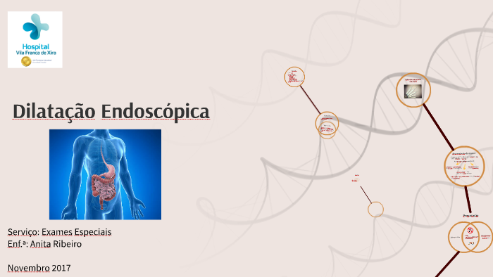Dilatação Endoscopica by Anita Ribeiro