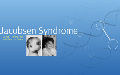 Jacobsen Syndrome by Maggie Sharp on Prezi