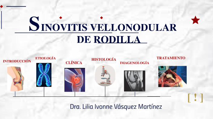 SINOVITIS VELLONODULAR DE RODILLA by LILIA IVONNE VASQUEZ MARTINEZ on Prezi