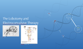 The Lobotomy and Electroconvulsive Therapy by Antonio Burgess on Prezi