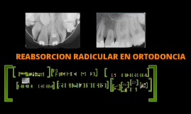 REABSORCION RADICULAR EN ORTODONCIA by Misael Rios Ruiz on Prezi